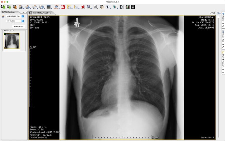 Dicom Viewer free recommended apps for Mac (Extension dcm) | Mac Cheat ...